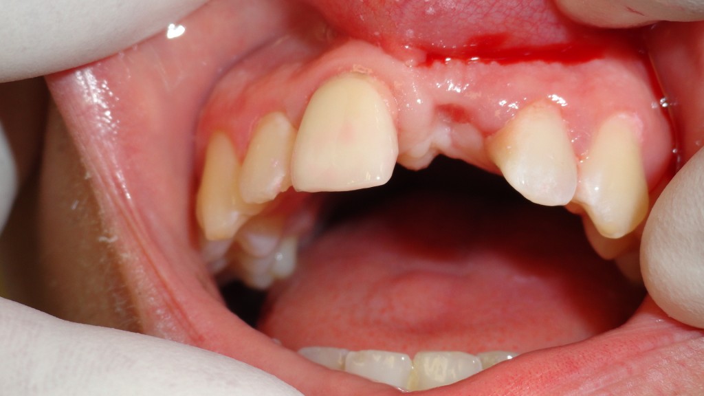 Free Dental Implant Seminars - Brian Jackson, DDS