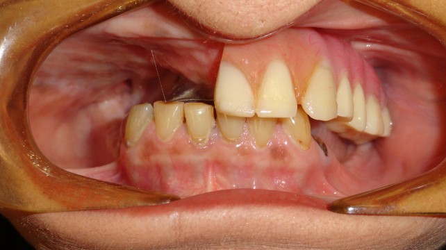 Free Dental Implant Seminars - Brian Jackson, DDS